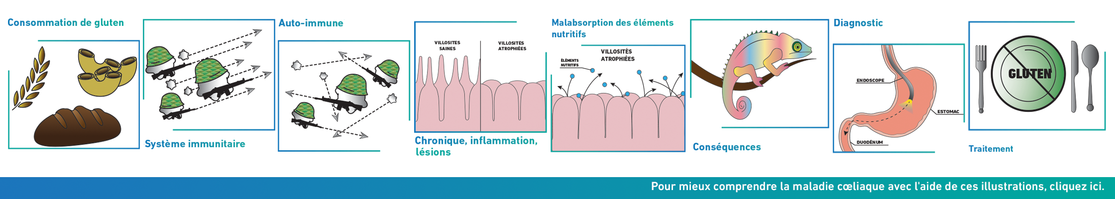 Maladie coeliaque Coeliaque Québec